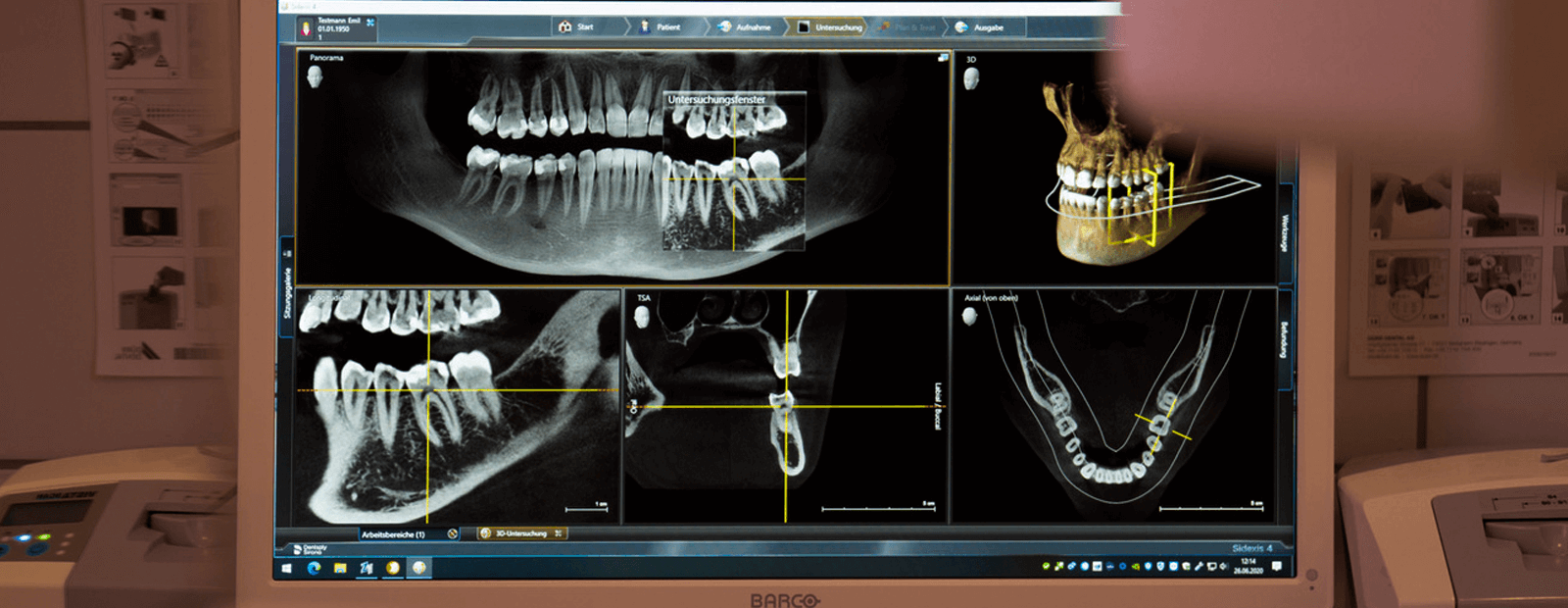 DVT – modernste digitale Röntgentechnik in der Zahnmedizin